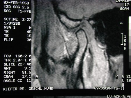 Magnetic Resonance Tomography (MRT) | Dr. Madsen