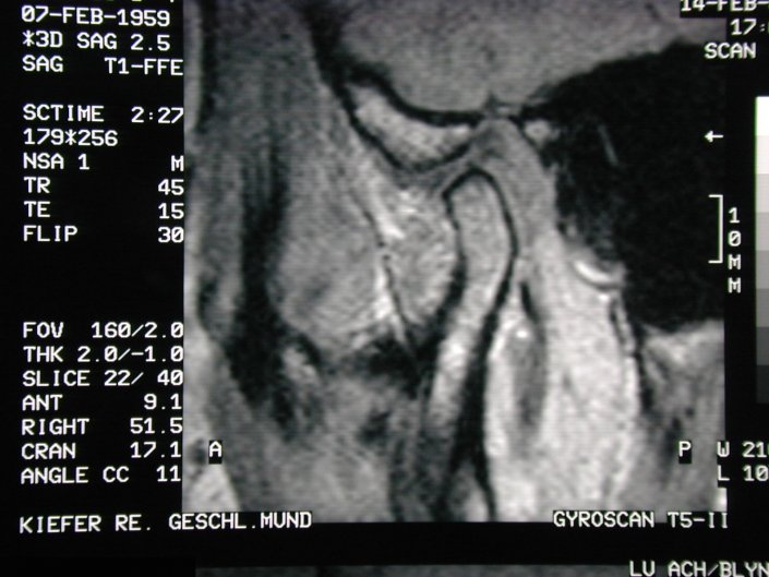 Meistens überflüssig: MRT der Kiefergelenke | Dr. Madsen