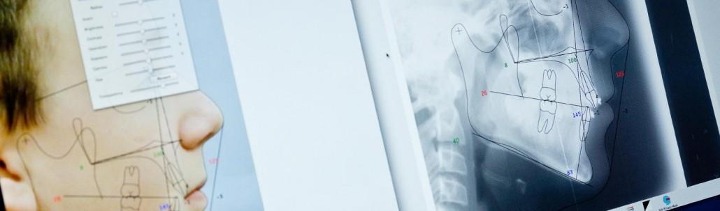 Fernröntgen seitlich (FRS) | Dr. Madsen