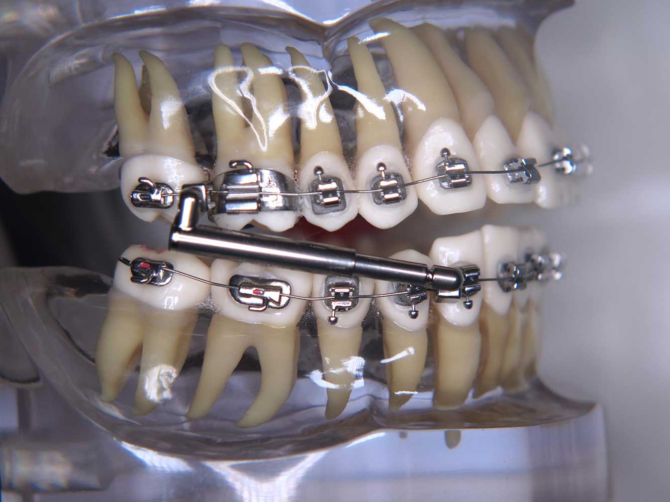 BioBiteCorrector | Dr. Madsen