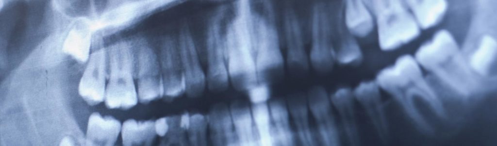 Häufige Fragen zum Kiefergelenk | Dr. Madsen